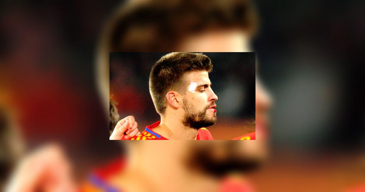 Así captaron las imágenes: Mire como fue el golpe del defensa español ...