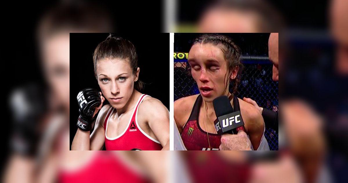 UFC 248: Joanna Jedrzejczyk terminó con el rostro desfigurado tras ...