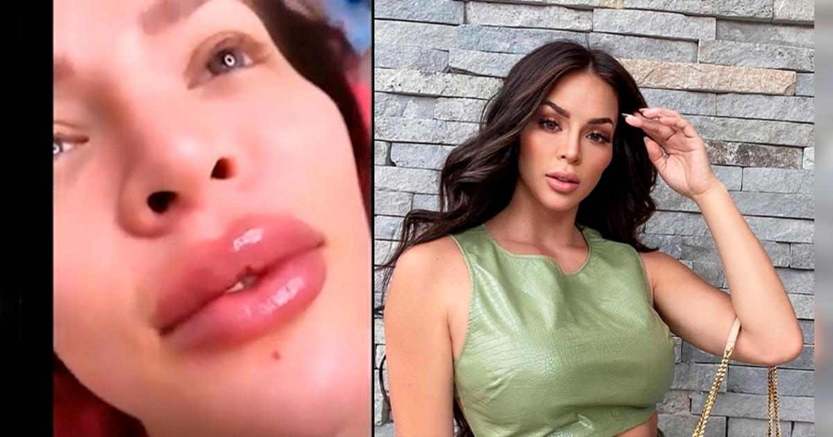 Sheyla Rojas comparte los nuevos retoques que se hizo en el rostro