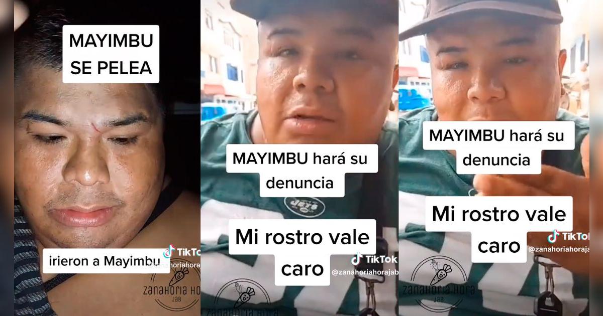 Mayimbú fue lastimado en pelea y denunciará a agresor: "Mi cara vale 80 ...