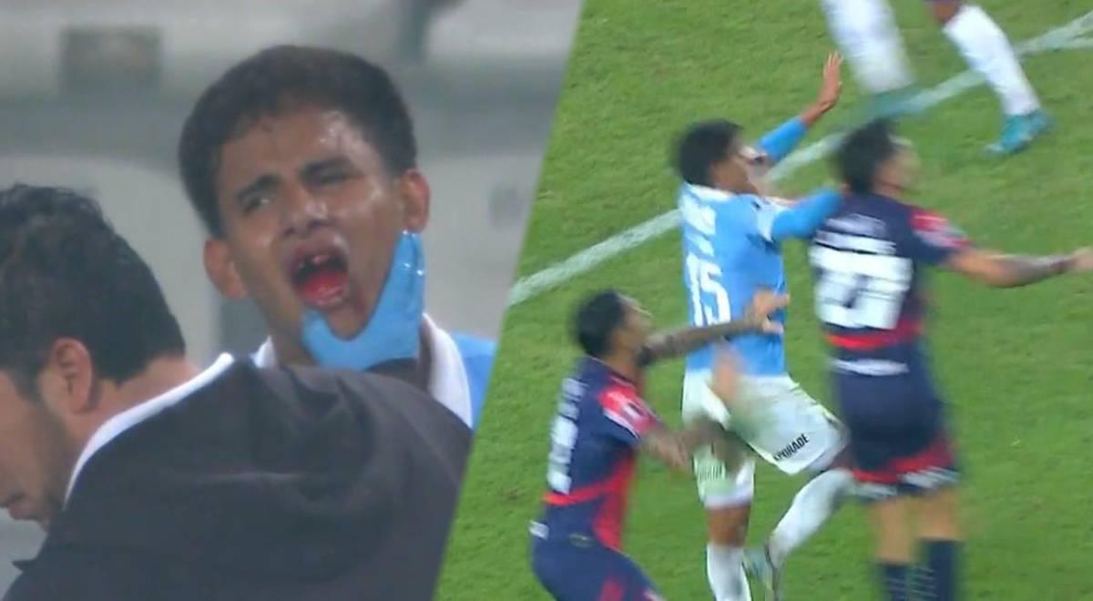 Sporting Cristal vs Cerro Porteño: Jhilmar Lora se quedó sin diente ...
